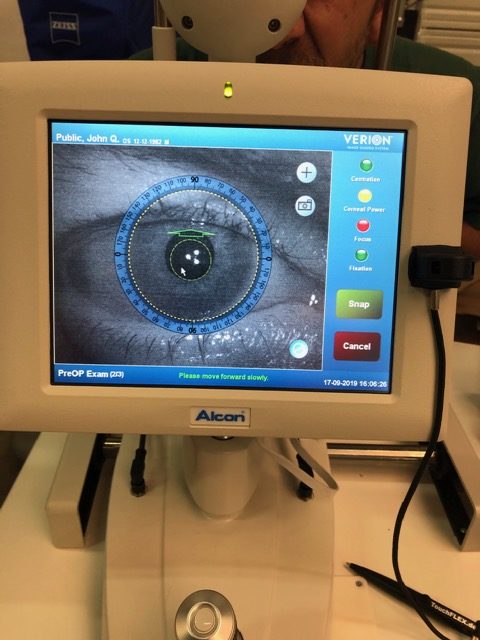 Biomètre Alcon Verion | Numelec